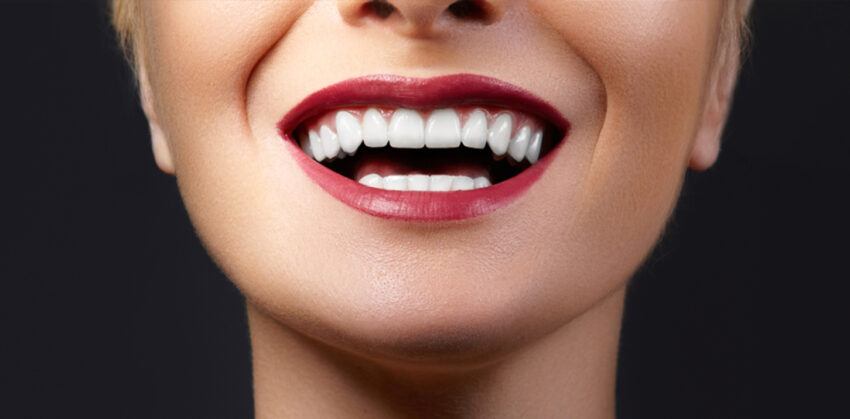 What Are Glass Ceramic Crowns in Cosmetic Dentistry?